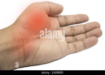 Rheumatoid Arthritis, Trigger finger, arthritis, wrist pain isolated on ...