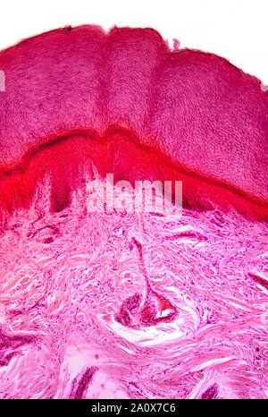 Brightfield photomicrograph, stained section of frog stomach showing ...