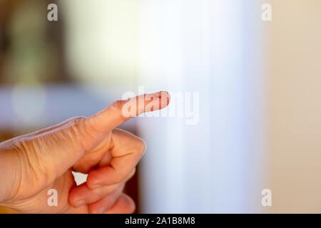 Wounded finger of a woman's hand Stock Photo - Alamy