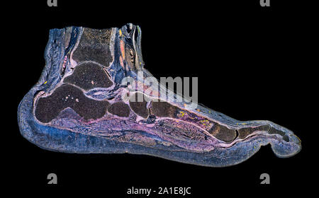 Human fetal foot section showing general structure, darkfield ...