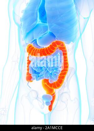 Ulcerative colitis as an inflammatory intestine with healthy and ...