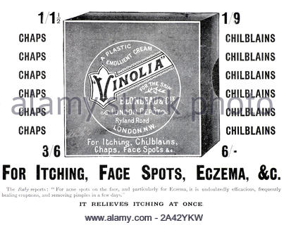 Vintage illustration Advert for Eczema cure eczema in infants, mother ...