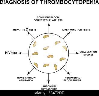 Causes of thrombocytosis. An increase in platelets in the blood ...