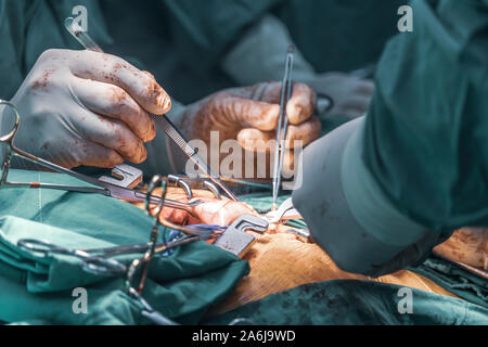 A group of surgeons is operating at the hospital, close-up of hands ...