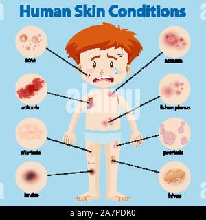 Diagram showing different skin conditions illustration Stock Vector ...