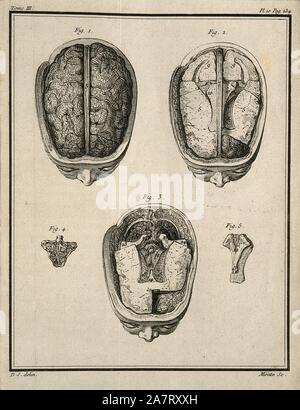 Wax Anatomical Model Of The Human Head Showing Arteries And Veins Stock ...
