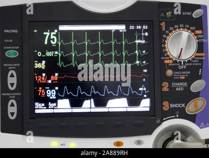 Portable ECG EKG Heart Monitor App running on iPhone 4 showing normal ...