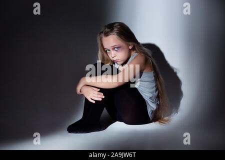 Sad and frightened little girl with bloodshot, bruised eyes crying ...