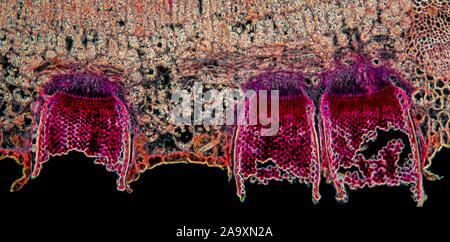 Aecidia in TS Berberis leaf, darkfield photomicrograph Stock Photo - Alamy