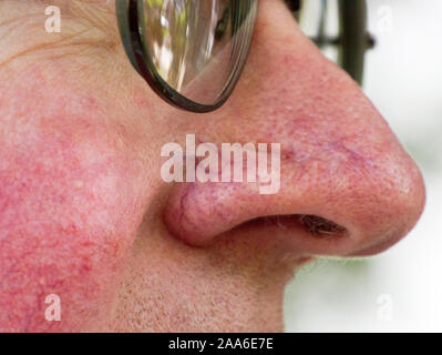 Blood in the veins, blood vessels, white blood cells and platelets ...