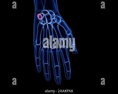 Pisiform bone, computer illustration Stock Photo - Alamy