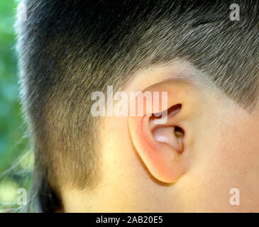 Deformed ear. Abnormal development of the auricle. Plastic surgery and ...