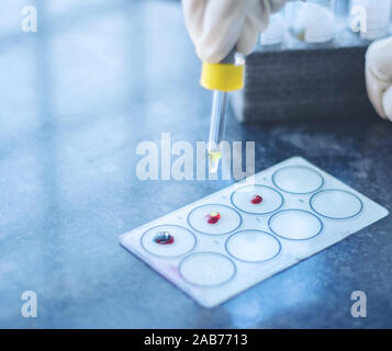 Close up, Hands testing Blood group called Protocol of ABO Blood ...