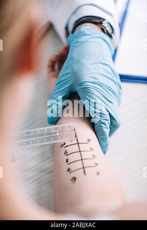 cropped view of allergist holding ruler near man with marked back Stock ...