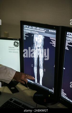 Radiology chief physician Andrea Rieber-Brambs in the reporting of ...