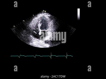 Screen of an ultrasound machine with a heart image Stock Photo - Alamy