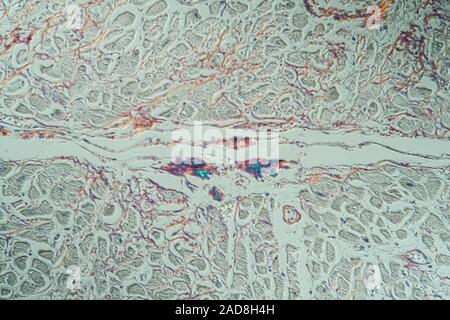 medicine microscope microscopy histology heart coronary artery vein ...