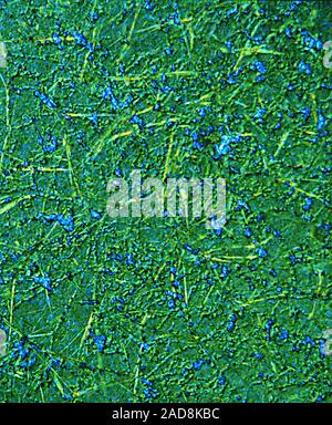 Mushrooms and bacteria destroy emulsion film under the microscope 200x ...