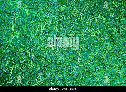 Mushrooms and bacteria destroy emulsion film under the microscope 200x ...