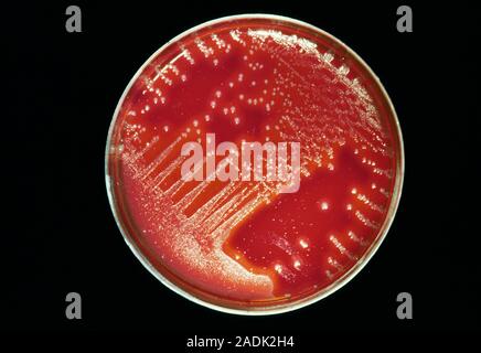 Blood Agar Streptococcus Pyogenes