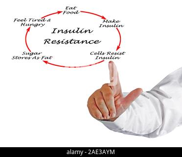 Development of Insulin Resistance Stock Photo - Alamy