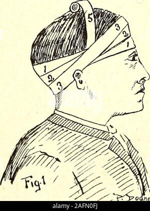 Head bandage for lower jaw fracture Stock Photo - Alamy