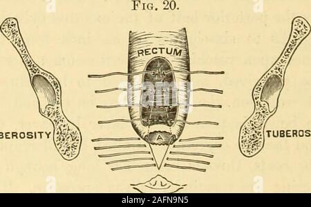 . Clinical gyncology, medical and surgical. the median line one ...