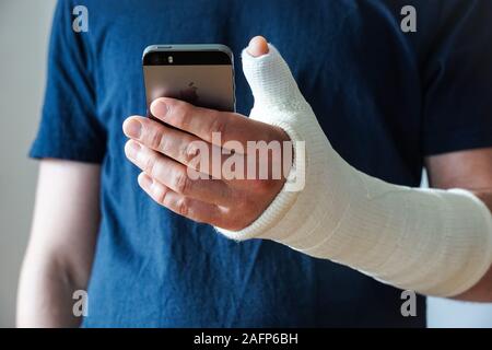 Broken hand with plaster cast close up Stock Photo - Alamy