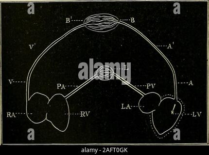 . Diseases of the heart and thoracic aorta. , or Corrigans pulse (after ...
