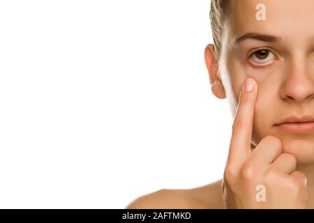 Young woman pulling her lower eyelid with her finger on white ...