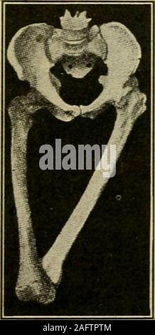 . A manual of operative surgery . Posterior posterior. FIG. 138 ...