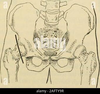 . Manual of operative surgery. -^ inches below theHarrison Crippsline ...