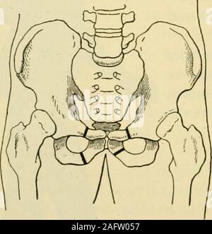 . Manual of operative surgery. Step 6.—Close the wound in layers ...