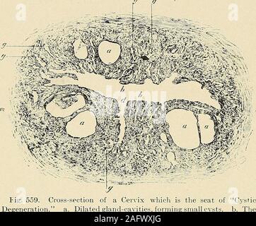 . The diagnosis of diseases of women . Cervix is exposed by a self ...