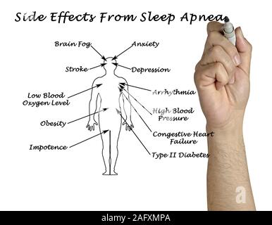 Side Effects From Sleep Apnea Stock Photo - Alamy