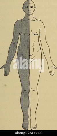 Hysteria and certain allied conditions, their nature and treatment ...