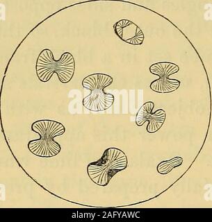 . Urinary deposits : their diagnosis, pathology, and therapeutical ...