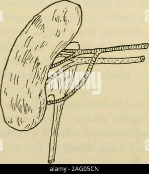 . A manual of operative surgery . T KIDNEY, FROM THE FRONT. (From a ...