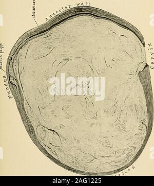 . The diagnosis and treatment of diseases of women. e of: Posterior ...