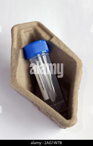 An empty plastic jar for stool sample with privacy protection to hide ...