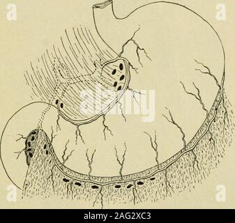 . Manual of operative surgery. Transverse colon Iostirior layer of ...