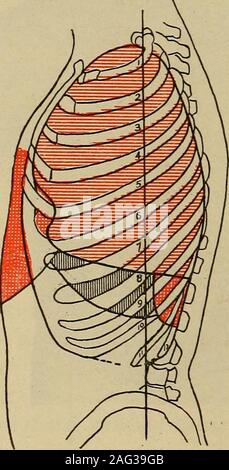 X-ray of Normal Kidneys Stock Photo - Alamy