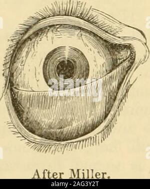 . A treatise on the diseases of the eye. he conjunctiva. If the ...