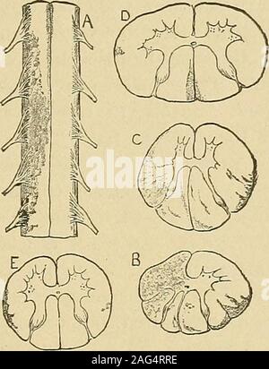 A manual of diseases of the nervous system . Fia. 16.>. ^24L^. Fig. 167 ...