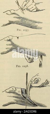 . Modern surgery, general and operative. ion andloosening of a ...