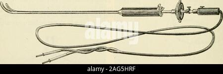 Modern surgery, general and operative . also enucleated. The bladder is ...
