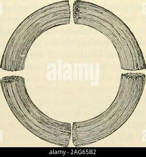 Modern surgery, general and operative . 7. Opening the Sheath for ...