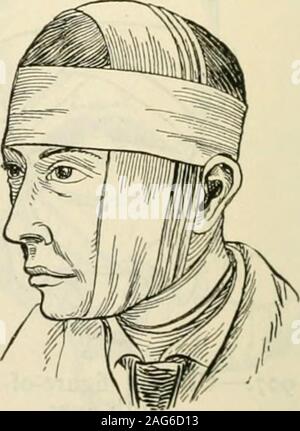 Head bandage for lower jaw fracture Stock Photo - Alamy