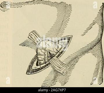 Modern surgery, general and operative . r, if colostomy hasbeen ...