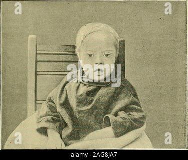 . Medical diseases of infancy and childhood. Congenital cretinism. The ...
